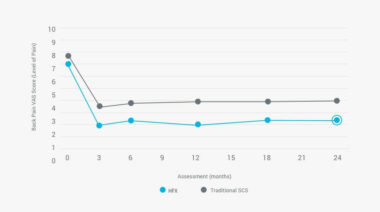 Overview - Nevro HFX Chronic Pain Relief